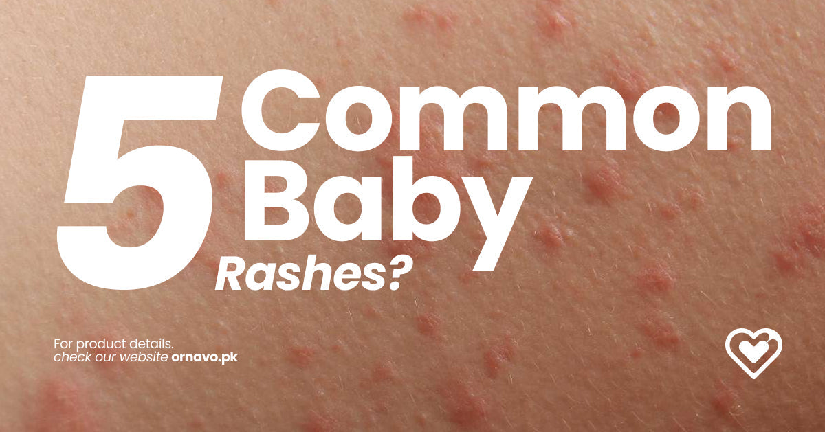 5 Common Baby Rashes Every Parent Should Know About – ORNAVO